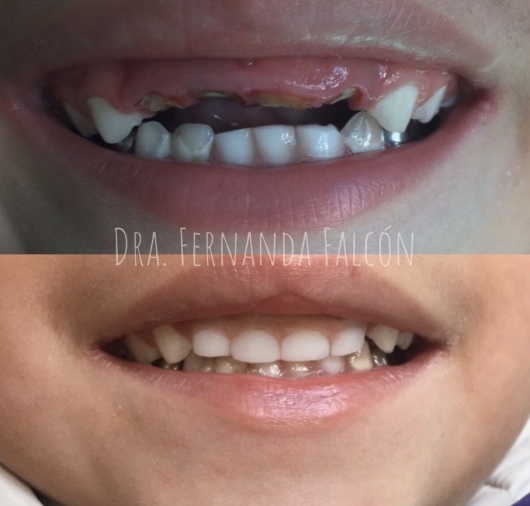 Dra. Fernanda Falcón - PADBee e-Cards